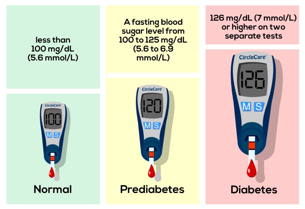 Diagnosis Of Diabetes Blood Sugar Test Random Plasma Glucose Test Diagnosis Of Diabetes Blood Sugar Test Random Plasma Glucose Test