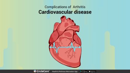 What are the complications caused by Arthritis? | CircleCare