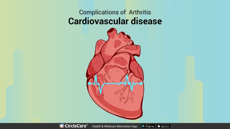 What are the complications caused by Arthritis? | CircleCare