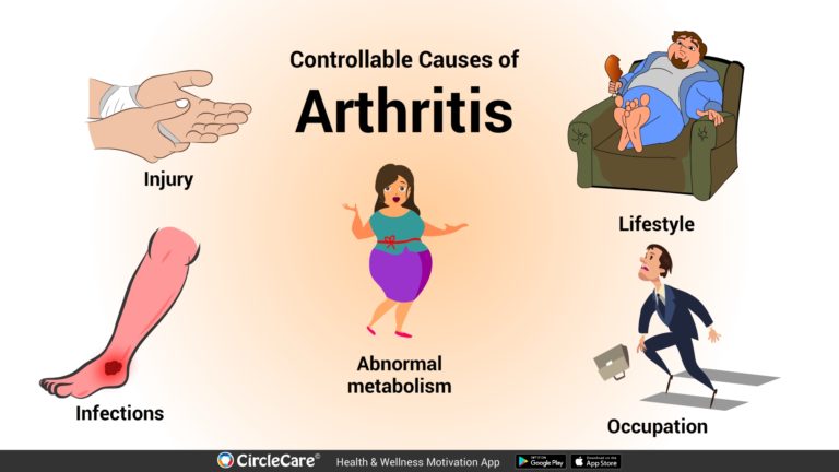 What are the major causes of Arthritis? | CircleCare