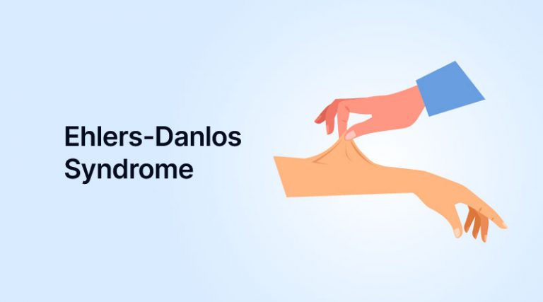 What Is Ehlers-Danlos Syndrome – Symptoms and Treatments - CircleCare