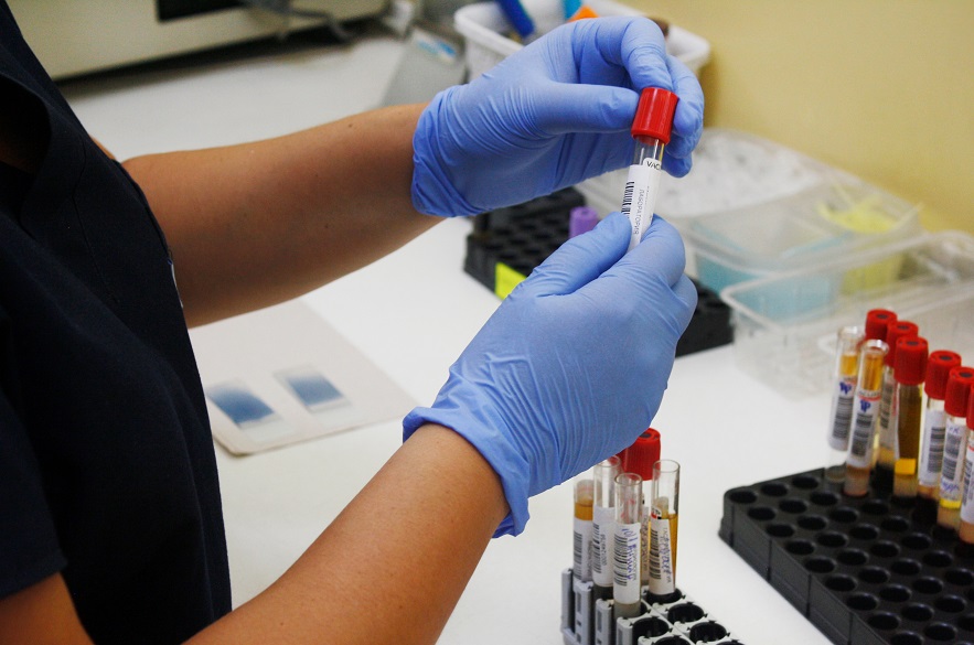 How Your Blood Test Will Be Kept and Treated - CircleCare